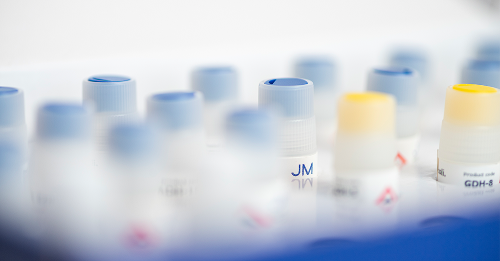 Enzyme kits | Johnson Matthey | Johnson Matthey